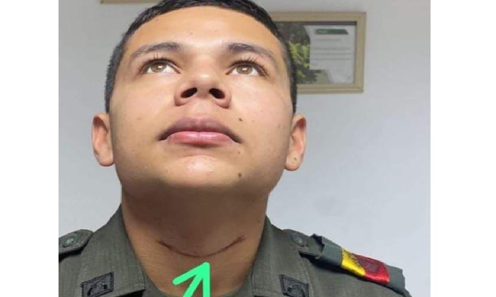 Policía logró salvarse de ‘Pisa Suave’ que intentó ahorcarlo - LA ...